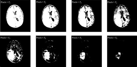 Tumor Detection By Using Mts Eight Thresholds Provided Based On Otsus