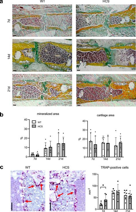 Normal Histological Callus Maturation But Increased Osteoclast Numbers