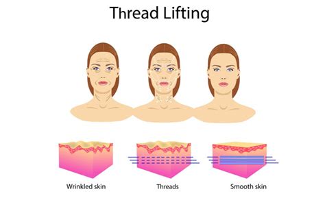 What Is The Difference Between Mono Threads Vs Pdo Threads