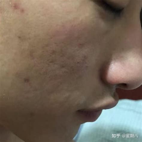 女朋友发朋友圈从来不让我露脸，是嫌弃我吗？ 知乎