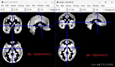 如何用掩模（mask 提取mri图像的原理与技术 掩膜提取 csdn博客