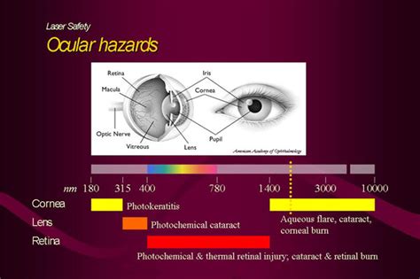 Category Laser Hazards Laser Pointer And Laser Alignment Tech