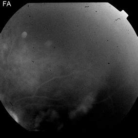 Discover Images Retina Image Bank