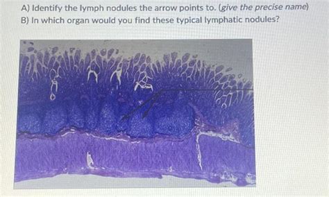 Solved A Identify The Lymph Nodules The Arrow Points To