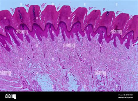 palm of hand light micrograph of a section through human skin from the