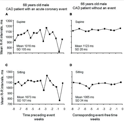 Representative Examples Of The Variability Of Mean R R Intervals In Download Scientific