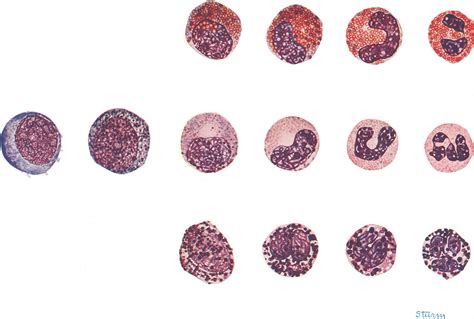 White Blood Cell Morphology Chart Red Blood Cell Morphology Size