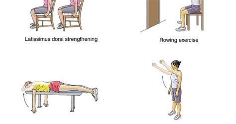 Summit Medical Group Shoulder Subluxation Exercises Stretches
