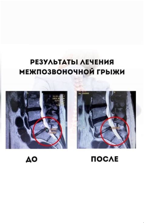 Медицинский центр МироМед 5 мифов успешного зачатия 😉 ⠀ 1️⃣ Позы «Закинь ноги на стену после