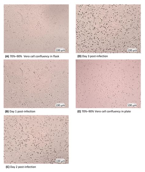 virus propagation and cell based colorimetric quantification article