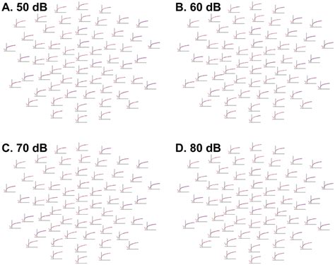 Waveforms At Each Electrode Depicting Separately In Each Intensity Download Scientific Diagram