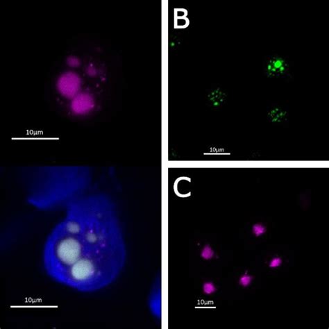 Transient And Stable Transformation Of Pyrenoid Related Genes In Download Scientific Diagram Transient And Stable Transformation Of Pyrenoid Related Genes In Download Scientific Diagram