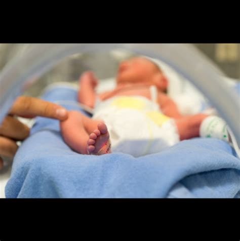 Нов скандал с новородено в болница бебчето със счупен крак след лечение от жълтеница За Жената