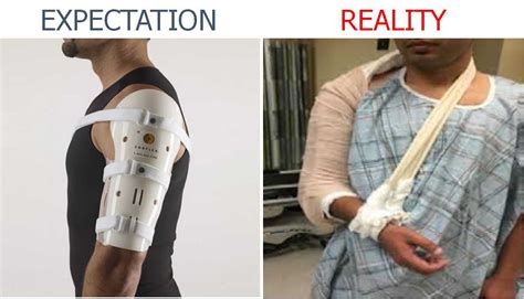 Functional Brace Humerus