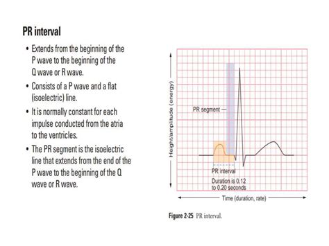 Ecg Steps 10 Steps In Ecg Interpretation Pptx