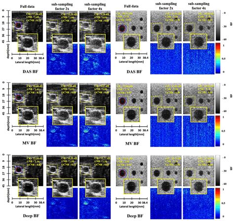 Comparison Of Various Beamformers For Phantom Data Using Uniform Download Scientific Diagram