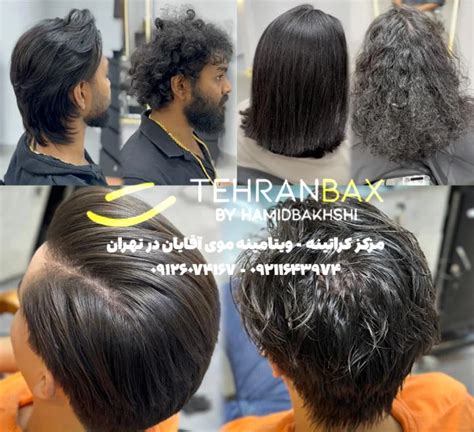 مرکز پروتئین تراپی مو مردانه در تهران تهران‌ بکس