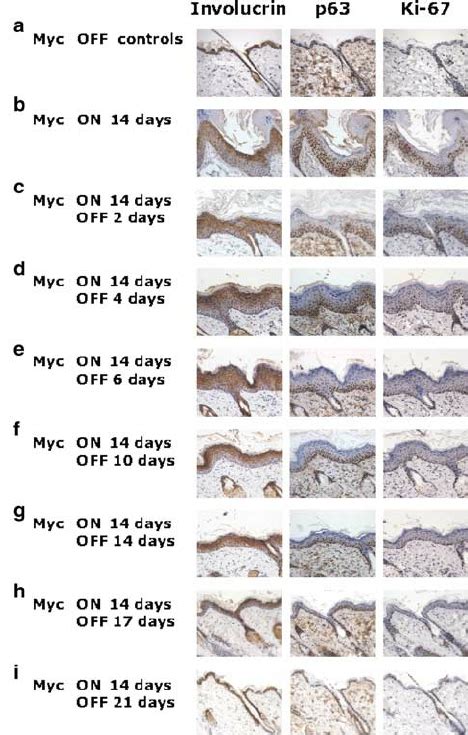 Myc Inactivation In Hyperplastic Skin Results In Tumor Regression By Download Scientific