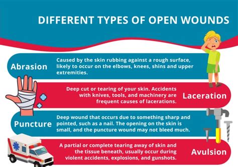 Open Wounds