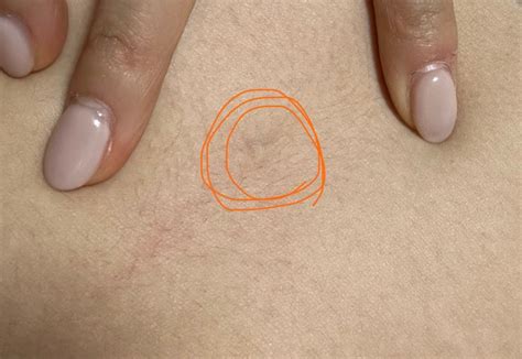 배 피부 안쪽에 뭔가 잡혀요 지식in