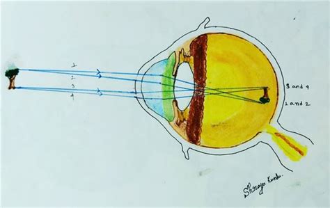 Schematic Of The Eye