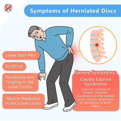 What To Do About Herniated Discs Understanding Symptoms Causes And