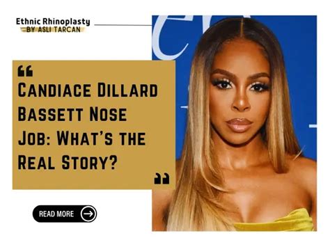 Candiace Dillard Bassett Nose Job Whats The Real Story