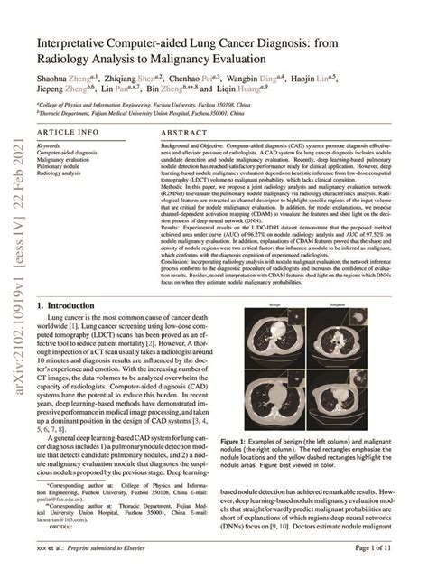 Interpretative Computer Aided Lung Cancer Diagnosis From Radiology