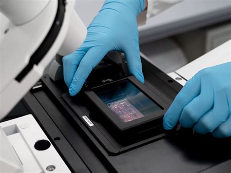 High Content Screening From Microscopy To Medicine Ibidi Blog