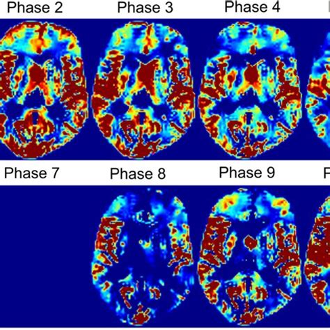 Pulse Wave Amplitude Maps Pulse Wave Amplitude Maps Of Each Cardiac Download Scientific