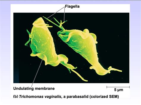 Parabasalid ~ Detailed Information Photos Videos
