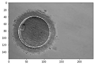 Python Image Segmentation To Find Cells In Biological Images Stack Overflow