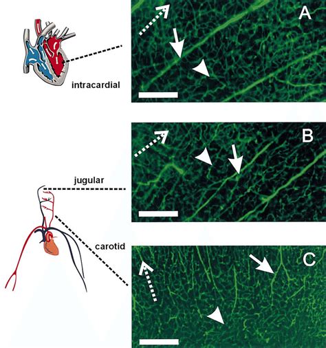 Comparison Of Different Injection Techniques Used To Visualize Download Scientific Diagram
