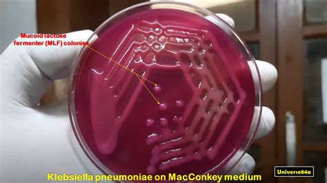 Macconkey Medium Introduction Principle Composition Preparation Pr