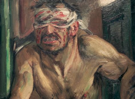 The Blinded Samson Lovis Corinth Fine Art Print Gallerythane