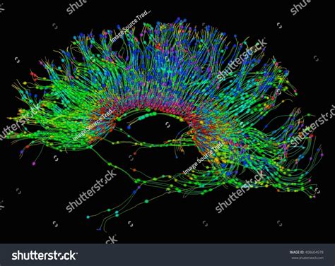 14 imágenes de Dti mri Imágenes fotos y vectores de stock Shutterstock