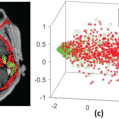 Schematic Flow Chart Of The Proposed Algorithm For Mri Based Sct Download Scientific Diagram
