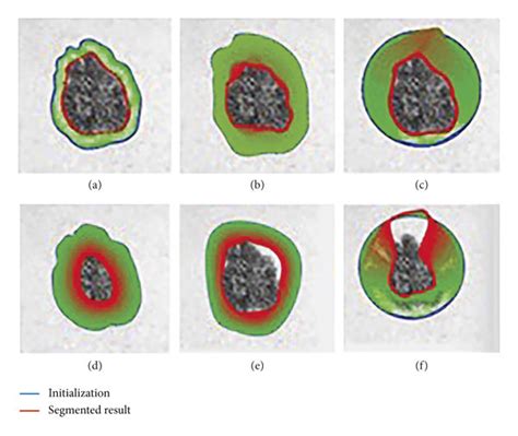 Comparison Of Different Initialization And Parameters A Appropriate