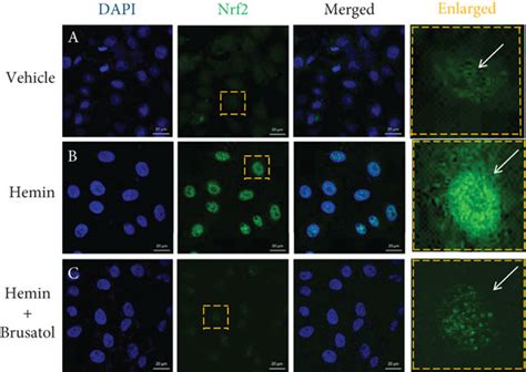 Rv Infection Depletes Hemin Induced Nrf2 Levels Beyond The Early Hours