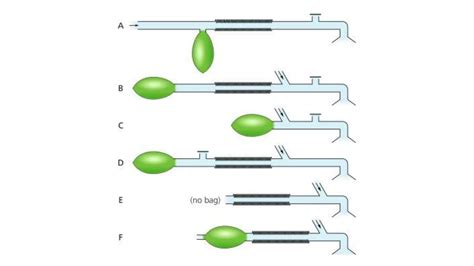 Breathing Systems Mapleson Classification Pdf