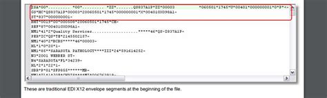 How To Ingest A X12 File Into Database Using Adf Microsoft Qanda