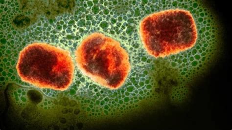 Monkeypox New Dangerous Strain Gains Ability To Spread Through Sex