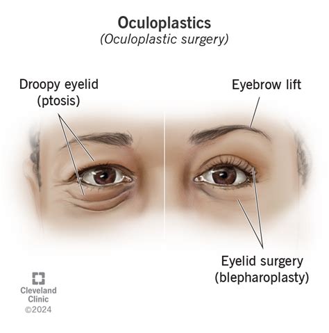 Oculoplastic Surgery Cost