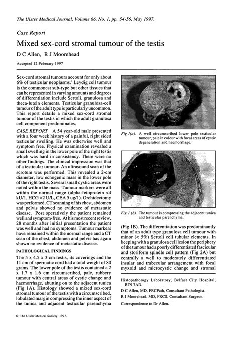 Mixed Sex Cord Stromal Tumour Of The Testis Pmc