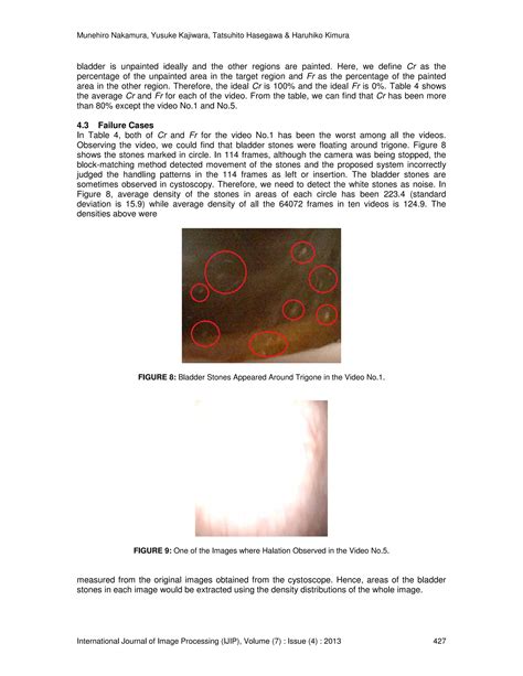 3d Position Tracking System For Flexible Cystoscopy Pdf