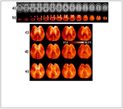 A The Reference Mri Used For The Spatial Normalization B The Mean