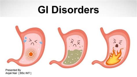 Pepticulcerdiseasepresentationpptx Group 4 Ppt