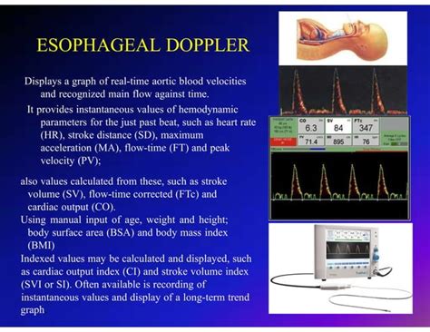 Cardiac Output Cardiac Output Monitoringpptx