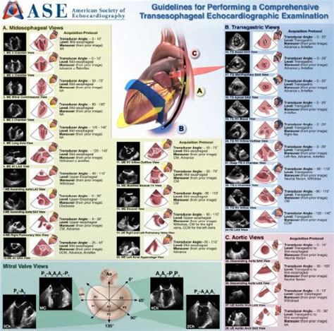 Guidelines For Performing A Comprehensive Transesophageal Echocardiogram Livros Na Amazon Brasil