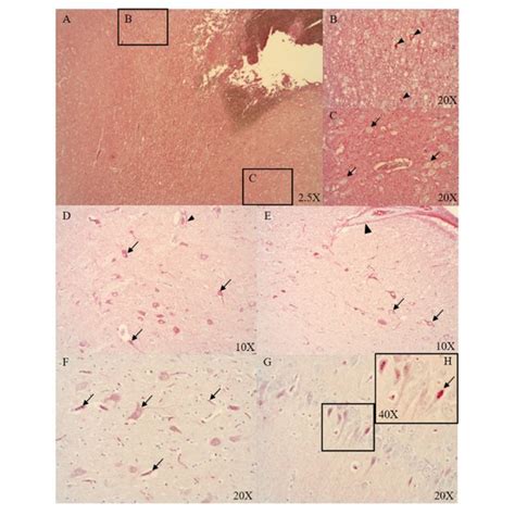 NeuN Expression In Cortical Neurons Of The Frontal Cortex Close To Download Scientific
